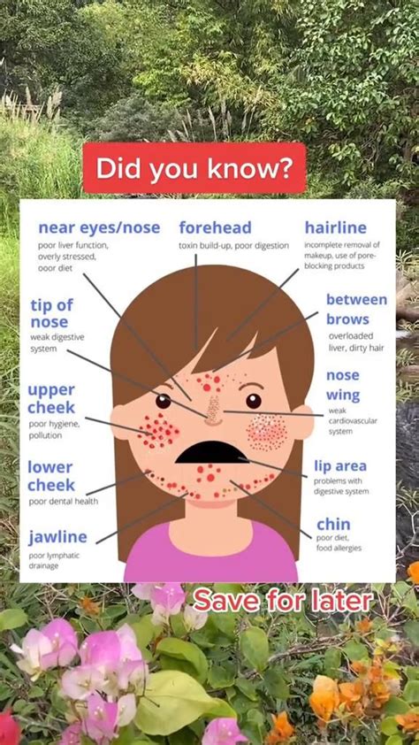 Pimple Location How To Get Rid Of Pimples Homemade Skin Care Natural Skin Care