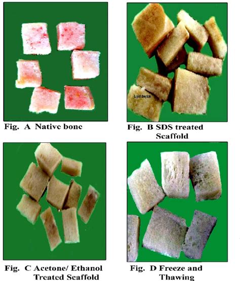 Figure 2 From Bone Tissue Engineering Latest Trends And Future