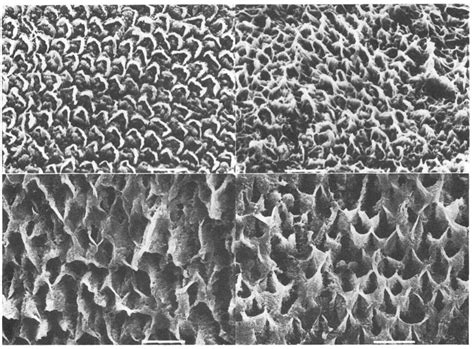 Etching Time For Primary Teeth At Erin Sizemore Blog