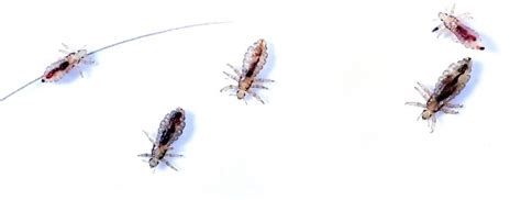 Can Cats Get Lice 9 Best Ways To Tell If Your Cat Got Em