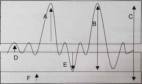 BIO 211 Spirogram Diagram Quizlet