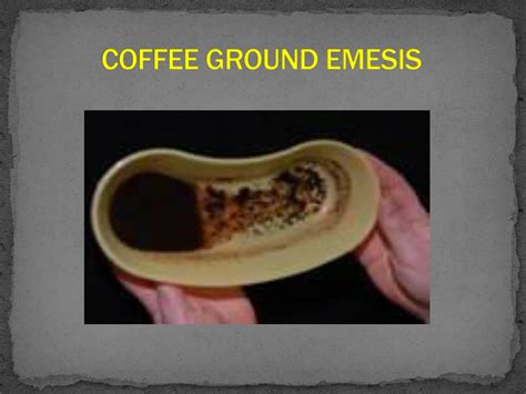 Ground Coffee Emesis At Jennifer Dermody Blog
