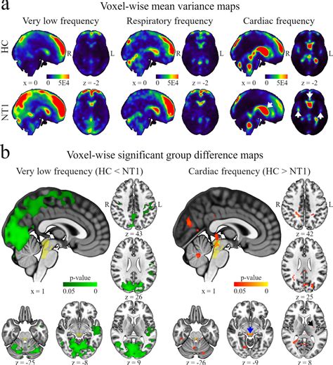 Frequency Wise Variance Results A Voxel Wise Mean Variance Maps Very