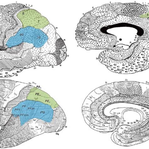 Pdf The Precuneal Cortex Anatomy And Seizure Semiology Pdf The Precuneal Cortex Anatomy And Seizure Semiology