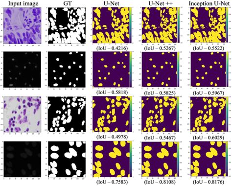 Image Segmentation With U Net Analytics Vidhya Vrogue Co