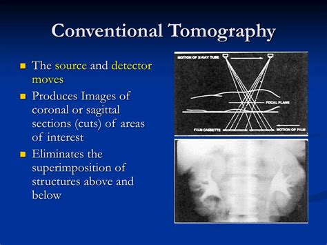 Ppt Computed Tomography Powerpoint Presentation Free Download Id 5366675