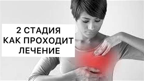 РАК ГРУДИ 2 СТАДИЯ ОПЕРАЦИЯ ХИМИОТЕРАПИЯ ОБЛУЧЕНИЕ СИМПТОМЫ РАКА Youtube