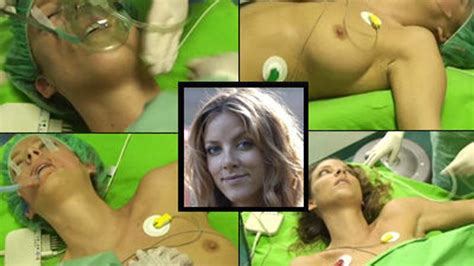 Kate Pre Op Part 2 Op Ecg Defib Cpr Et Tube O2 Mask Opander