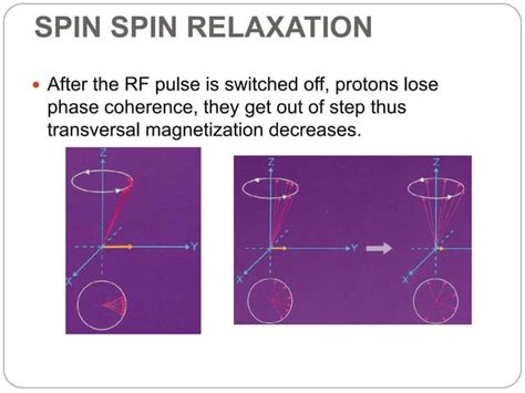 Mri Basic Principle And Sequences Pptx