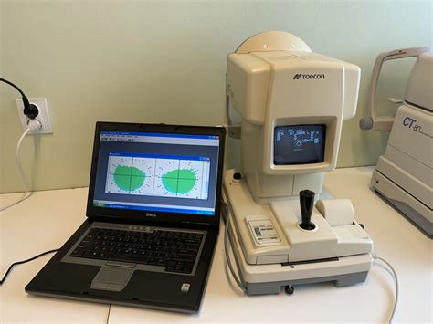 Topcon Sp 3000p Specular Microscope Optik Mash
