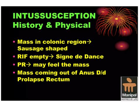 Pediatric Intussusception An Overview Pdf