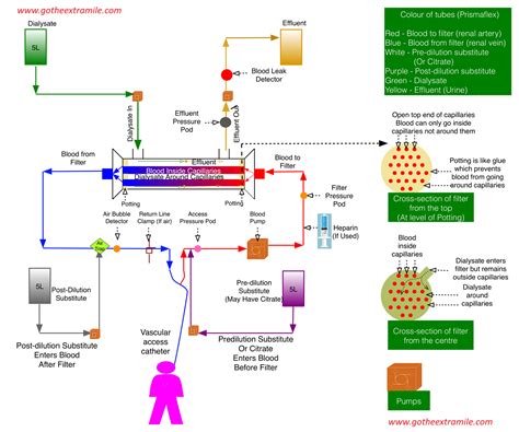 Understanding Crrt And Its Importance For Intensivist Go The Extra Mile