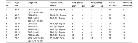 Spinal Cord Stimulation With Implanted Epidural Paddle Lead Relieves C Jpr