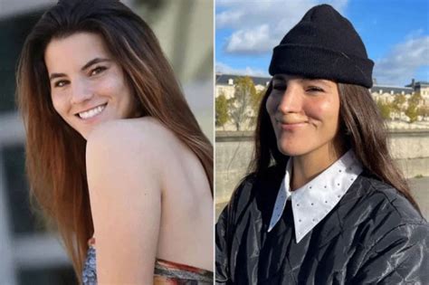 Нохойд хазуулсан скейтбордчин бүсгүй нүүрэндээ уруул шилжүүлэн суулгуулжээ