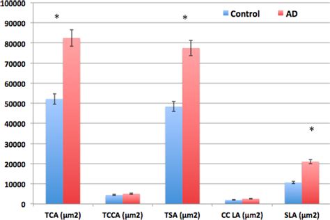 Illustrates Comparison Of Choroidal Parameters Between Ad And Control Download Scientific