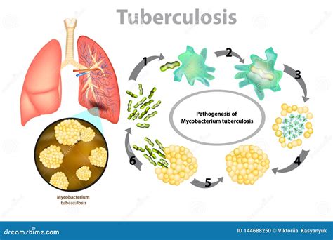 Tuberculosis Bacteria Life Cycle