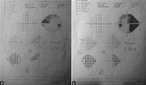 The Pan American Journal Of Ophthalmology