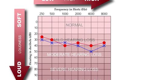 Understanding Hearing Loss Lessons Blendspace