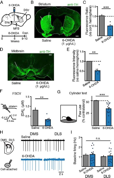 Figure 1 From Loss Of Nigral Excitation Of Cholinergic Interneurons