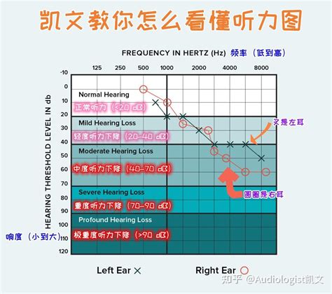 如何看懂听力检查报告快来看看吧