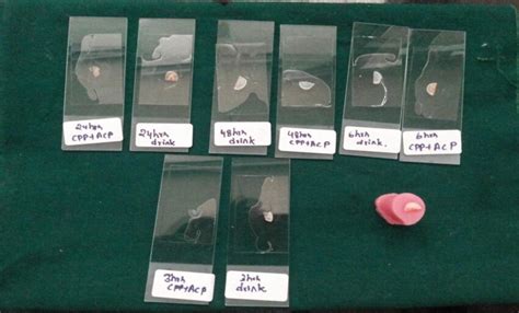 Hard Tissue Microtome Sectioned Tooth Samples Placed On The Glass Slide Download Scientific