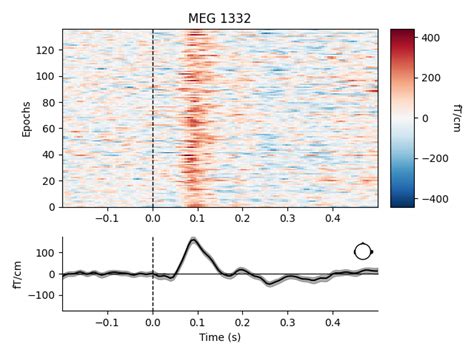 Overview Of MEG EEG Analysis With MNE Python MNE 1 1 1 Documentation