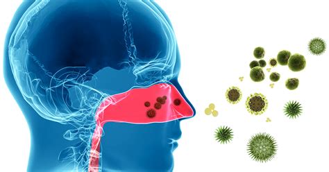 Five Things You Must Know About Fungal Sinusitis Alabama Nasal And Sinus Center Birmingham