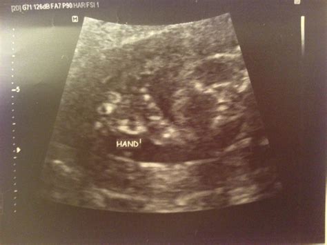 Conceiving Piper Let S Talk About Sex Baby