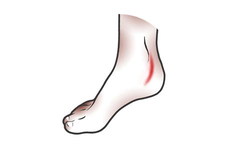 09 Tibialis Posterior