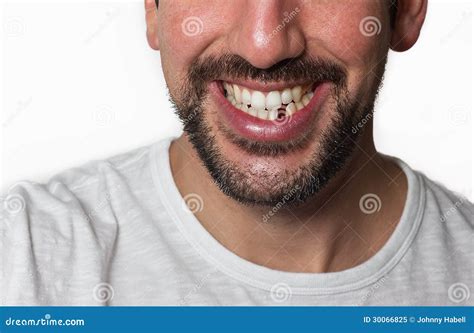 Man Missing Tooth Stock Image Image Of Humor Laughing