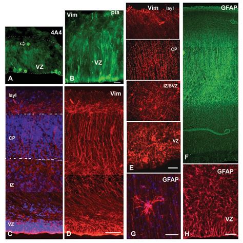 Figure 1 From Radial Glia Cells In The Developing Human Brain