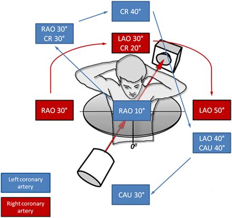 Dual Axis Rotational Angiography Protocol A First Sweep Blue Was