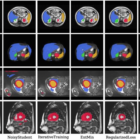 Qualitative Comparison Of The Segmentations From Pacingpseudo And Download Scientific Diagram