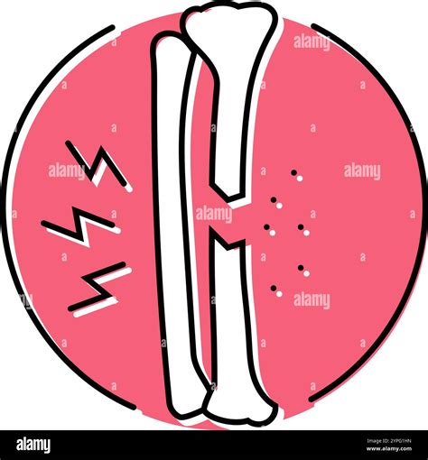 Anatomie Osseuse Du Tibia Banque Dimages Vectorielles Alamy