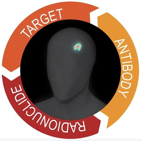 Cancers Free Full Text Diagnosis Of Glioblastoma By Immuno Positron Emission Tomography