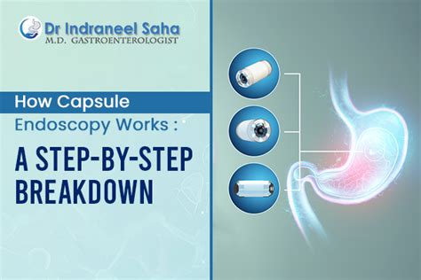Capsule Endoscopy Procedure A Detailed Guide On How It Works