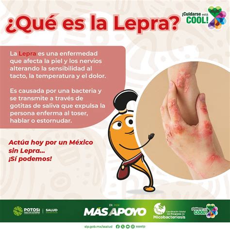 28 De Enero Día Mundial De Lucha Contra La Lepra 2024 Opinion