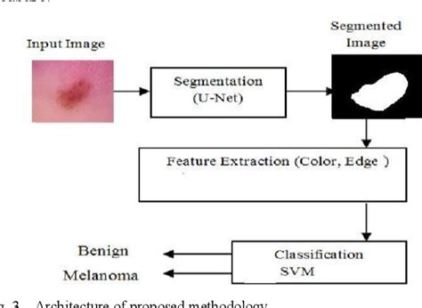 Figure 3 From Unet Segmentation Based Effective Skin Lesion Detection