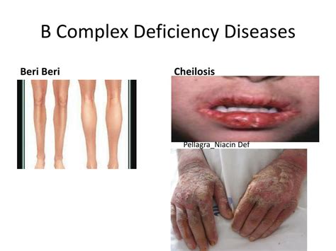 Ppt Vitamins And Minerals Powerpoint Presentation Free Download Id