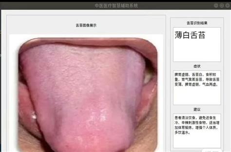 基于深度学习 卷积神经网络resnext50的中医舌苔分类系统 知乎