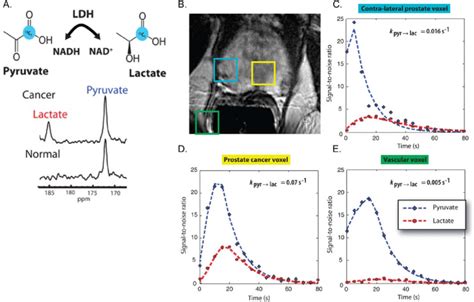 A Chemical Diagram Demonstrating Metabolism Of [1 13c]pyruvate To Download Scientific Diagram