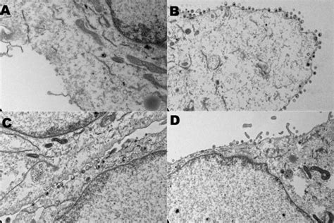 Electron Micrographs Of Wild Type And Recombinant Viruses Electron Download Scientific Diagram