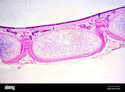 Elastic Cartilage Epiglottis Elastin