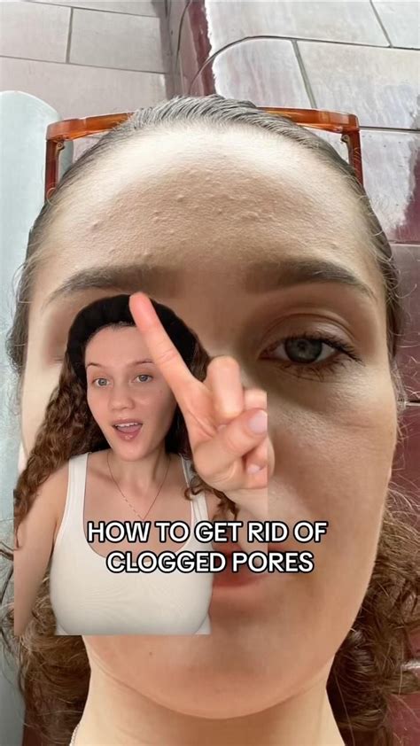 How To Get Rid Of Clogged Pores Havent Shared One Of These In A While So Here Are The Main