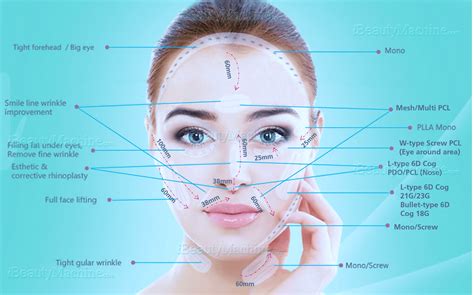 Pdo Thread Size Chart Dermax 47 Off