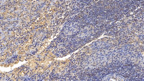Polyclonal Antibody To Glucocorticoid Induced Tumor Necrosis Factor Receptor Gitr Polyclonal