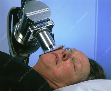 Skin Cancer From Radiation At James Depew Blog