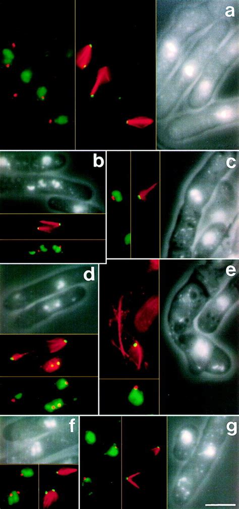 Overexpression Of Mal3⁺ Results In Defects In Form And Function Of The