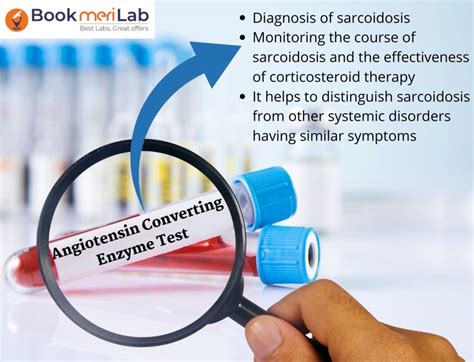 ACE Test Price Purpose Preparation Results 2025 Bookmerilab