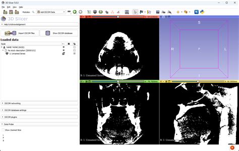 Bug 521 Data Is Loaded From Database But Doesnt Appear Under Loaded Data Support 3d